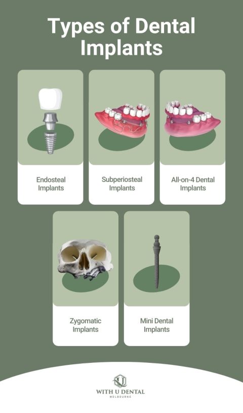Dental Implants Before and After - Dentist Hawthorn